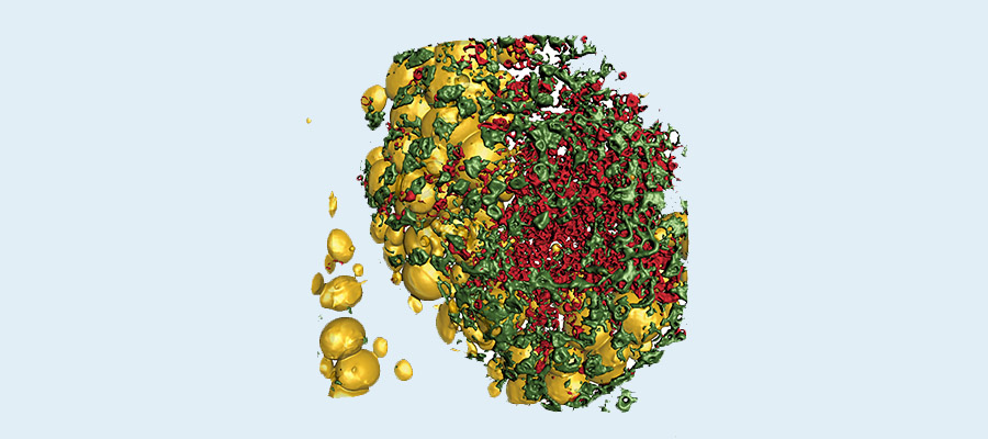 Abdominal fat cells could prevent sepsis | Centre for Cardiovascular ...