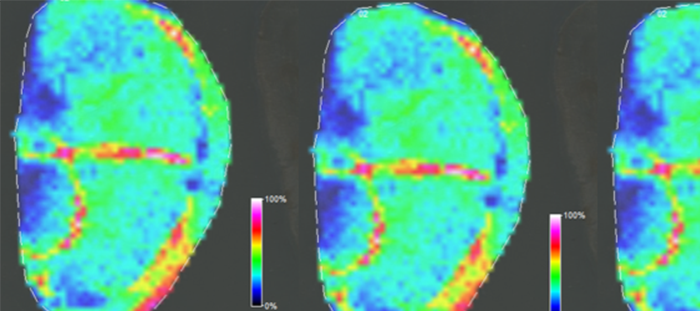 Using Mass Spectrometry Imaging to resolve corticosteroid action in the ...