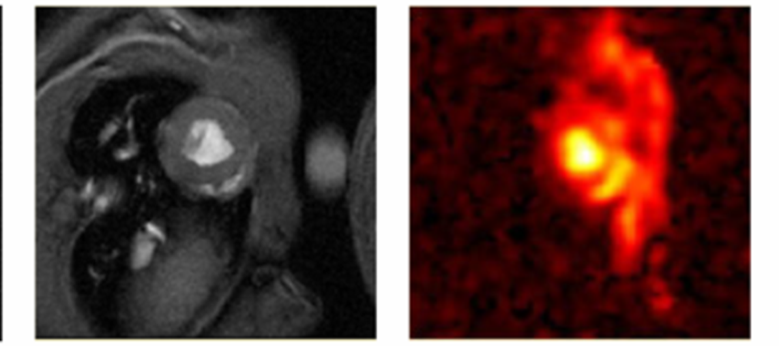 Cardiac 23Na MRI | Centre for Cardiovascular Science | Centre for ...